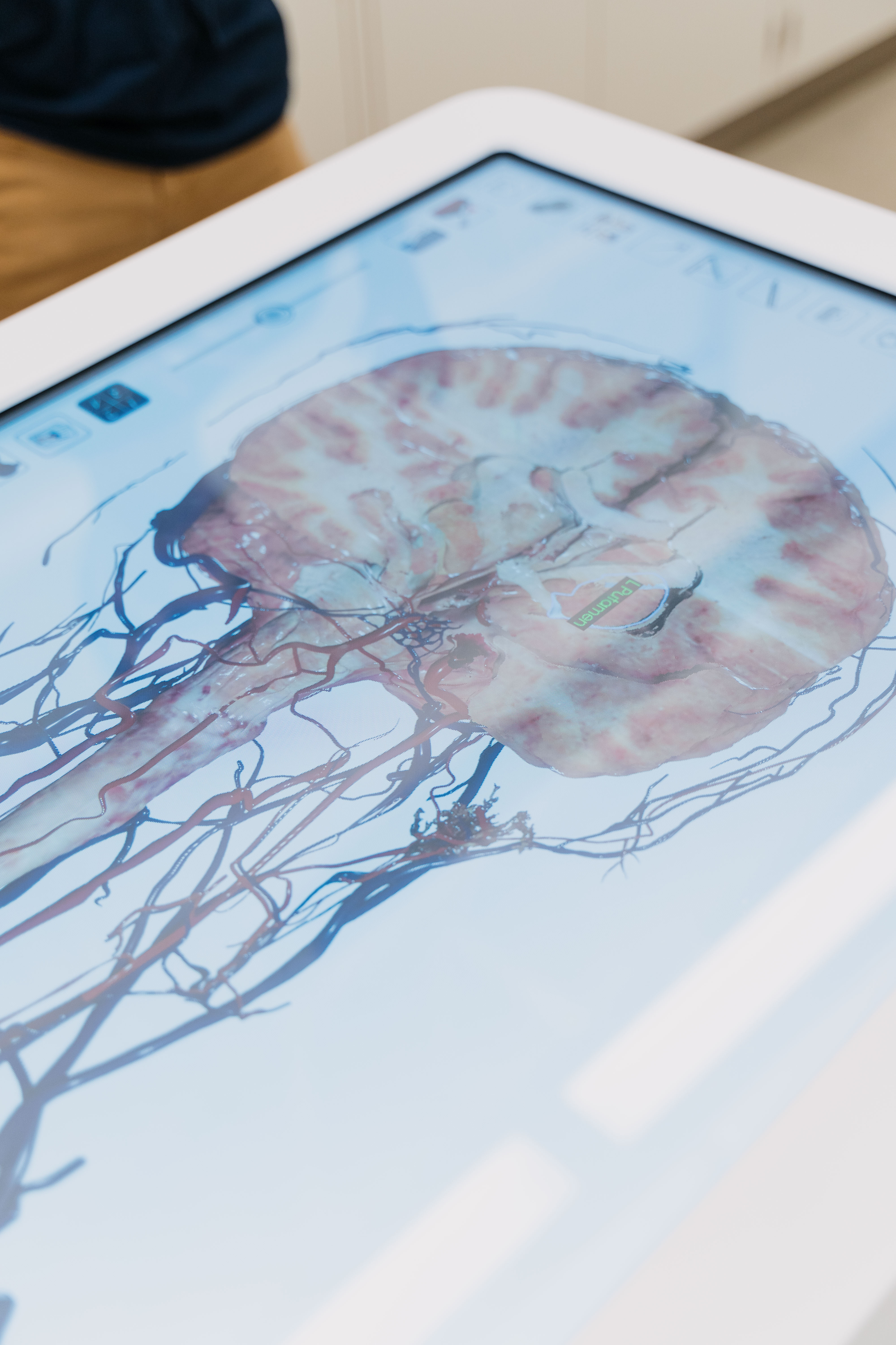 Augustana University Upgrades Neuroscience Minor to Major in Fall 2024 ...